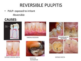 endo emergencies.pptx