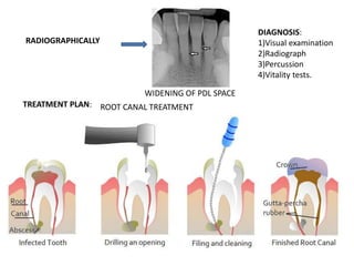 endo emergencies.pptx