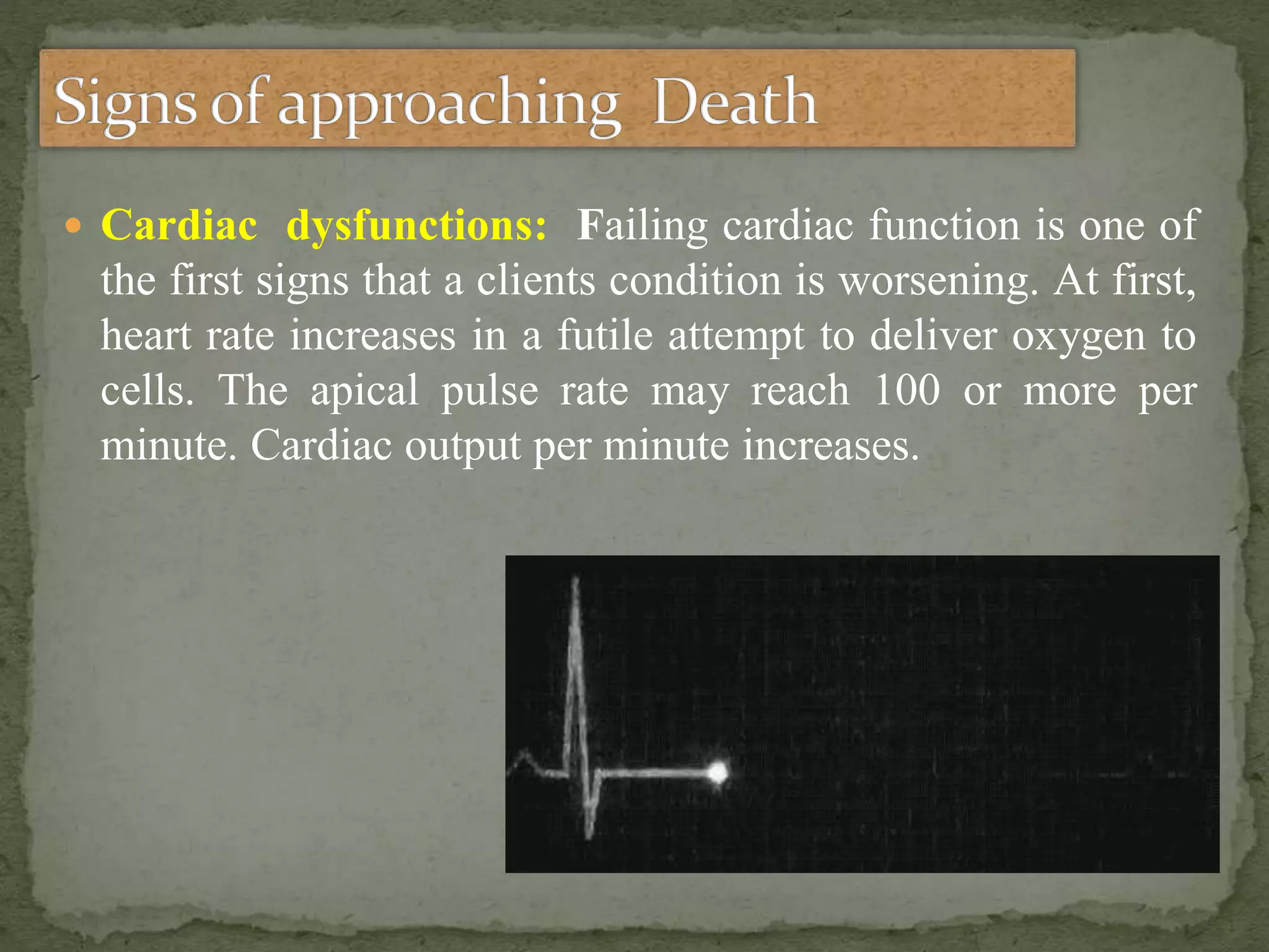 End of life care ( Stages of Dying) | PDF