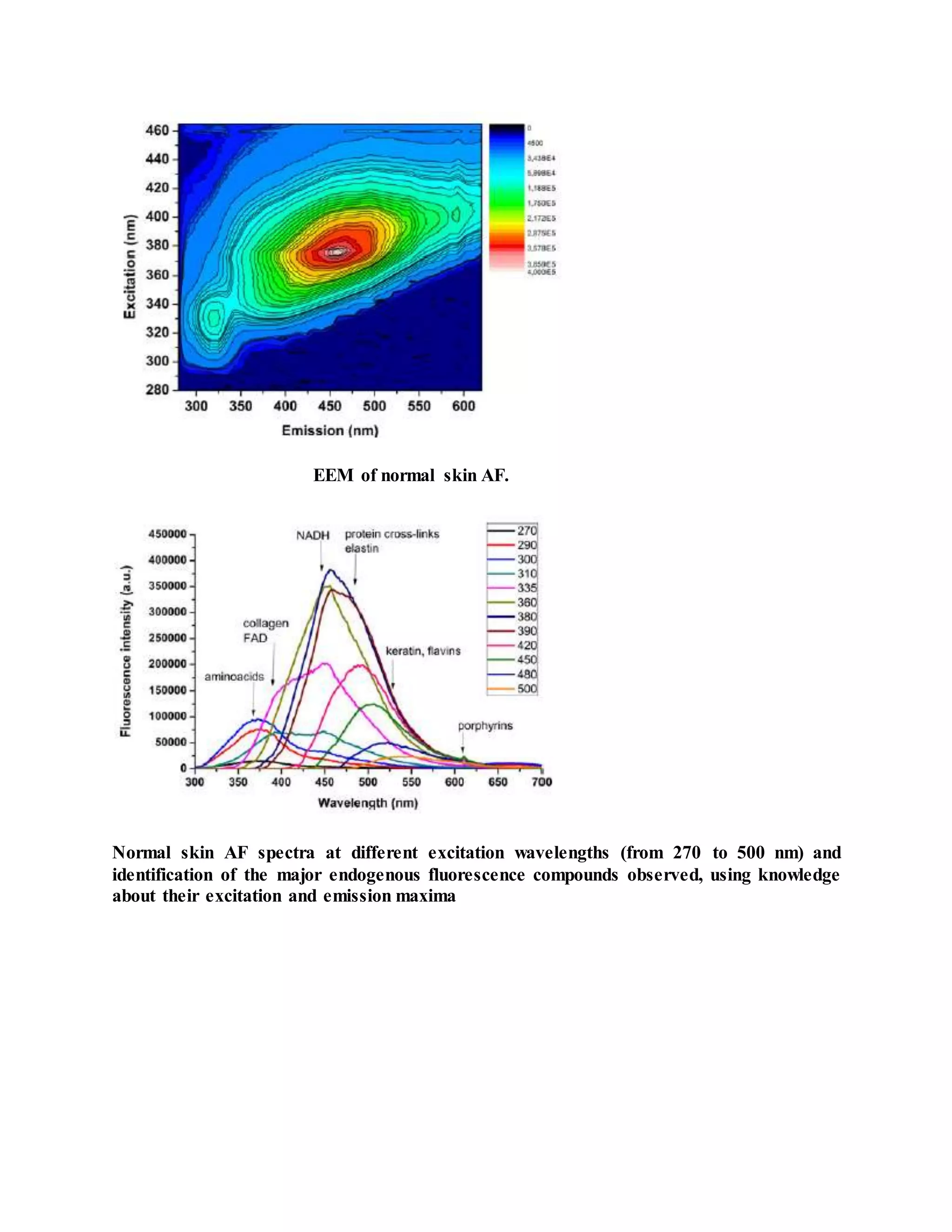 IEEE 2014 MATLAB IMAGE PROCESSING PROJECTS Endogenous and exogenous ...