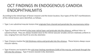 Endogenous fungal infections of eye | PPT
