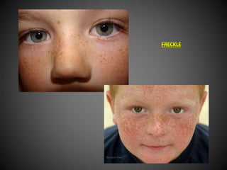Endogenous pigmentation | PPTX