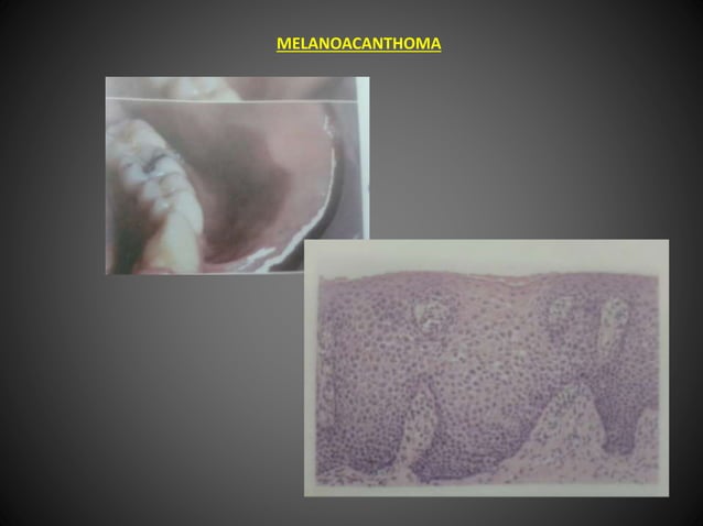 Endogenous pigmentation | PPTX | Skin and Dermatology | Diseases and ...