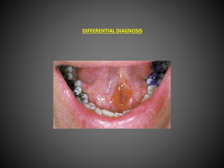 Endogenous pigmentation | PPTX