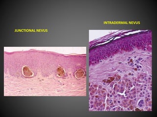 Endogenous pigmentation | PPTX