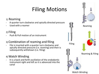 Endodontic Instruments | PPTX