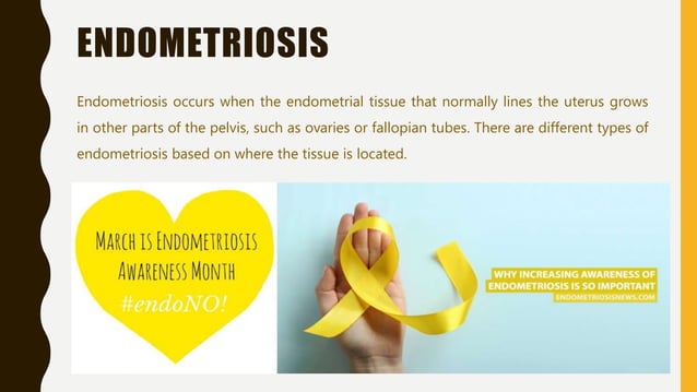 case presentation on bladder endometriosis | PPTX