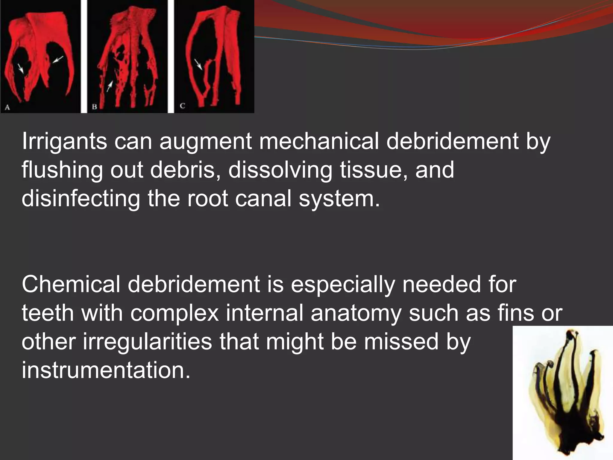 ENDODONTIC IRRIGANTS | PPT
