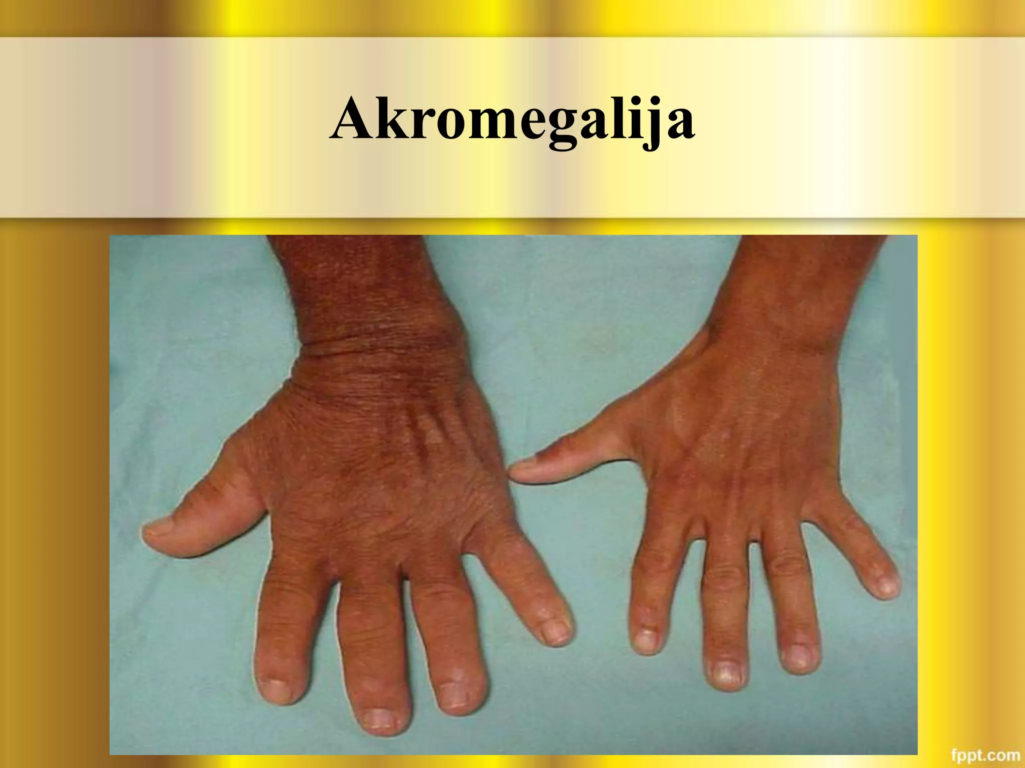 Endokrini sistem | PPT