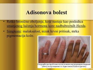 Endokrini sistem | PPT