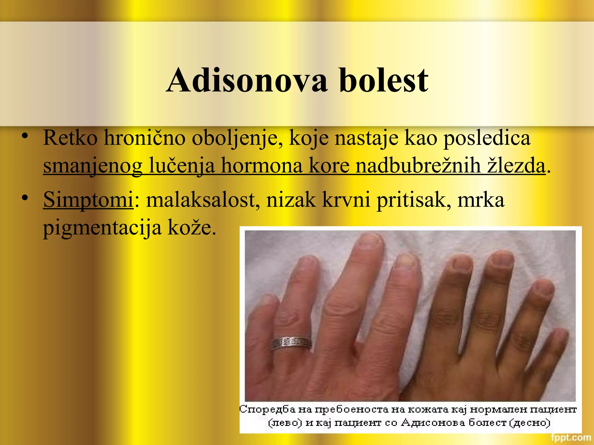 Endokrini sistem | PPT