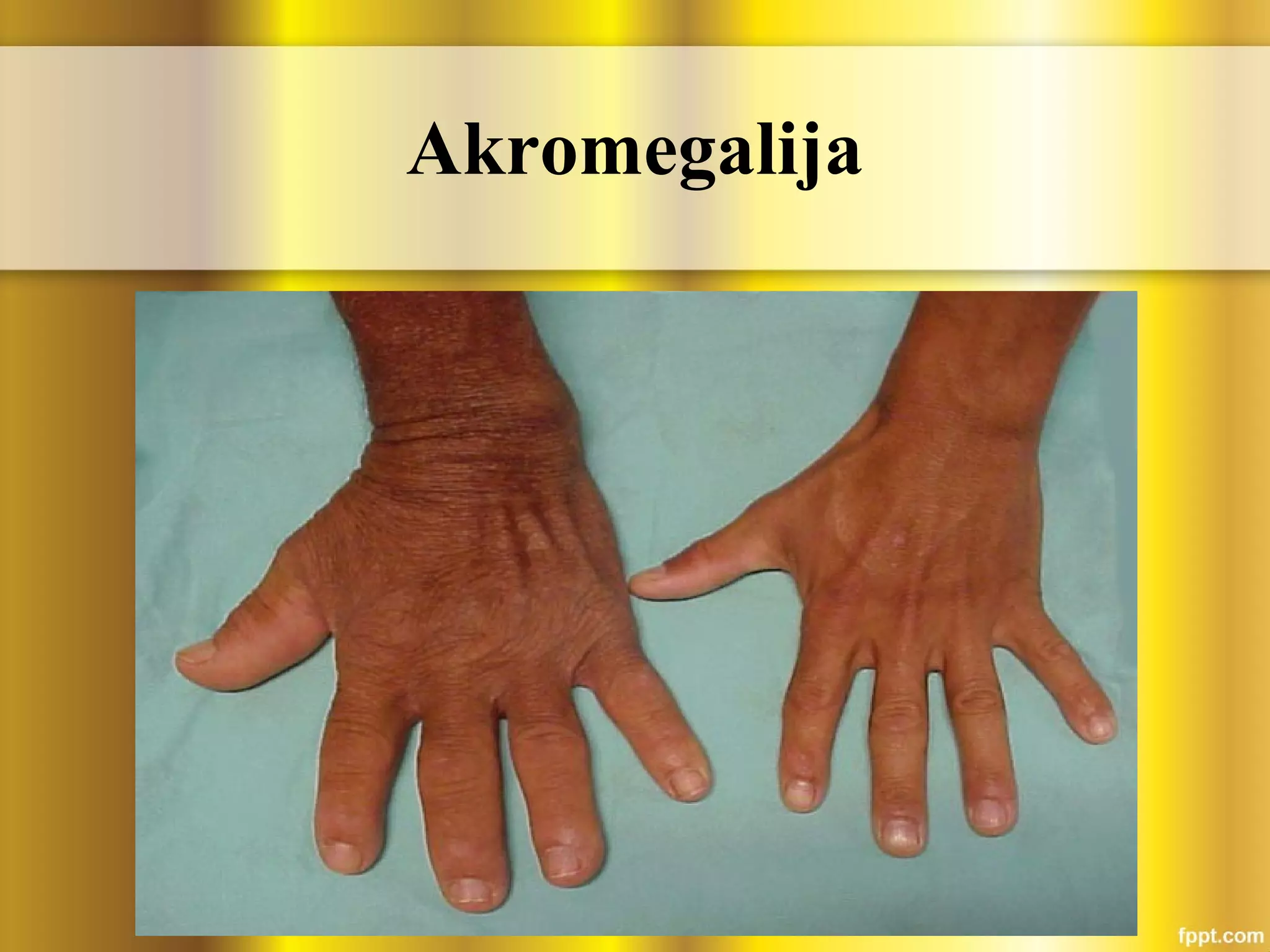 Endokrini sistem | PPT