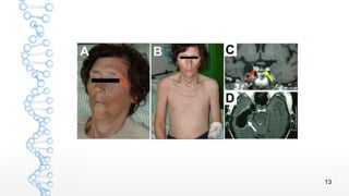 Endokrinologija - Interna medicina | PPT