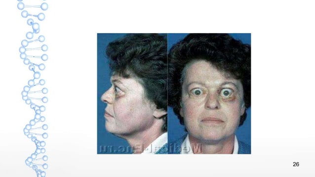 Endokrinologija - Interna medicina | PPT