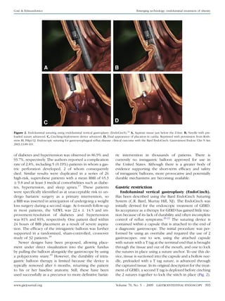 Primary endoluminal bariatric surgery | PDF