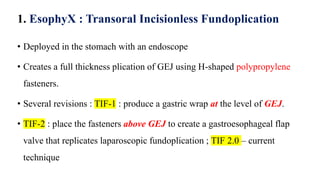 Endoluminal therapy in GERD | PPTX