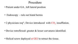 Endoluminal therapy in GERD | PPTX
