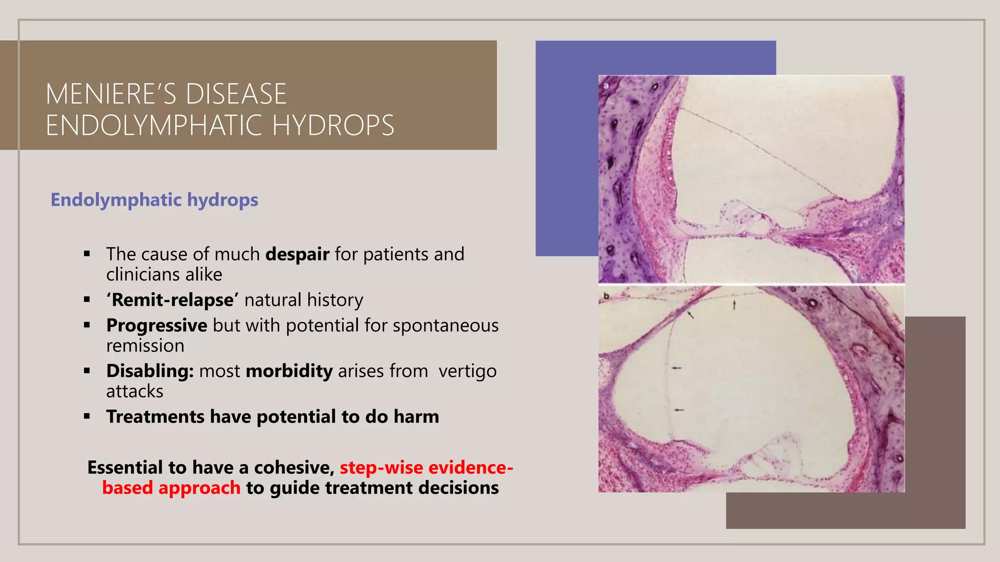 Endolymphatic Hydrops Surgery talk NOTSA 2022 (FINAL) .pptx