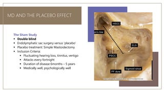 Endolymphatic Hydrops Surgery talk NOTSA 2022 (FINAL) .pptx