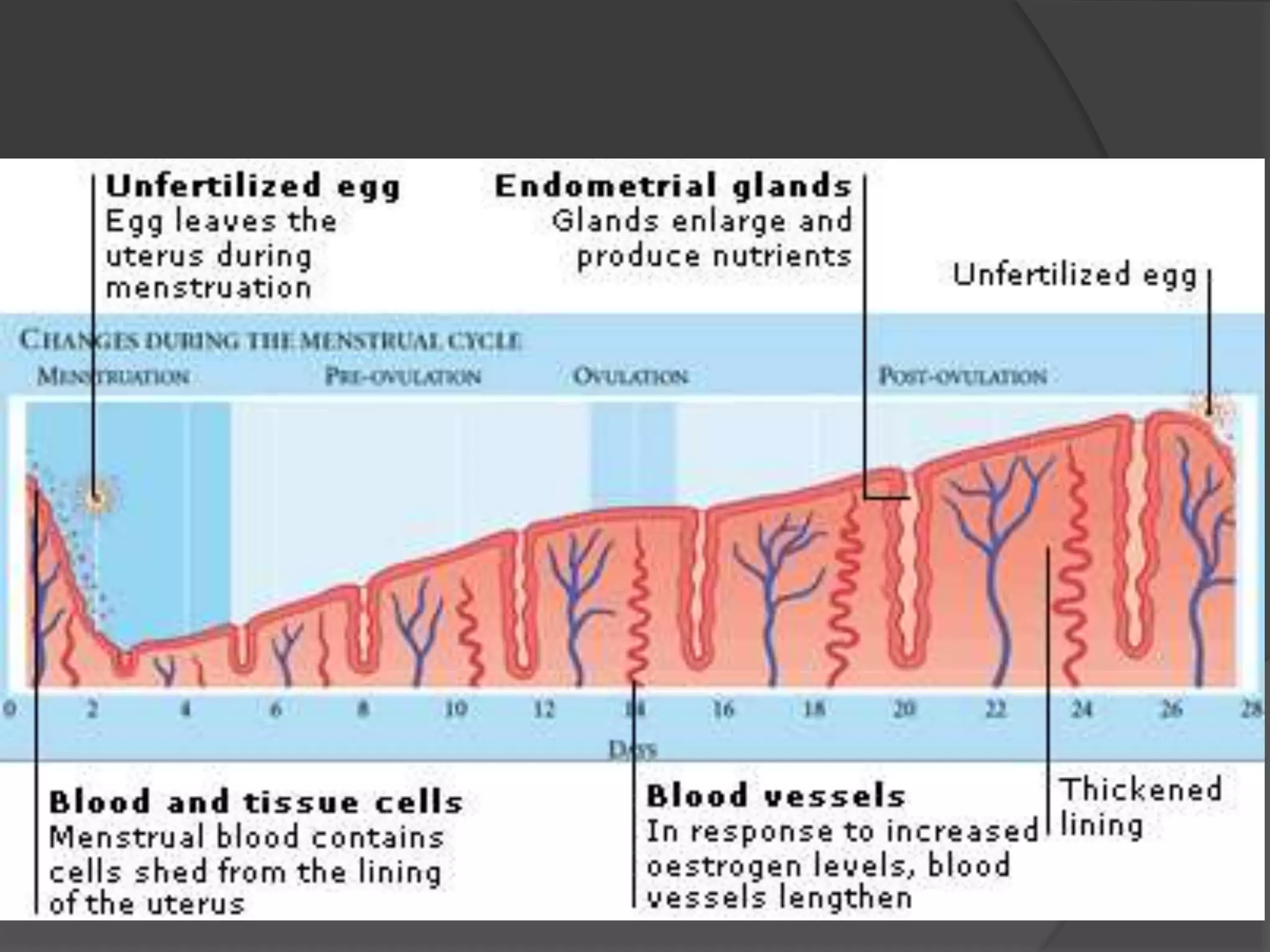 Endometrial hyperplasia | PPT