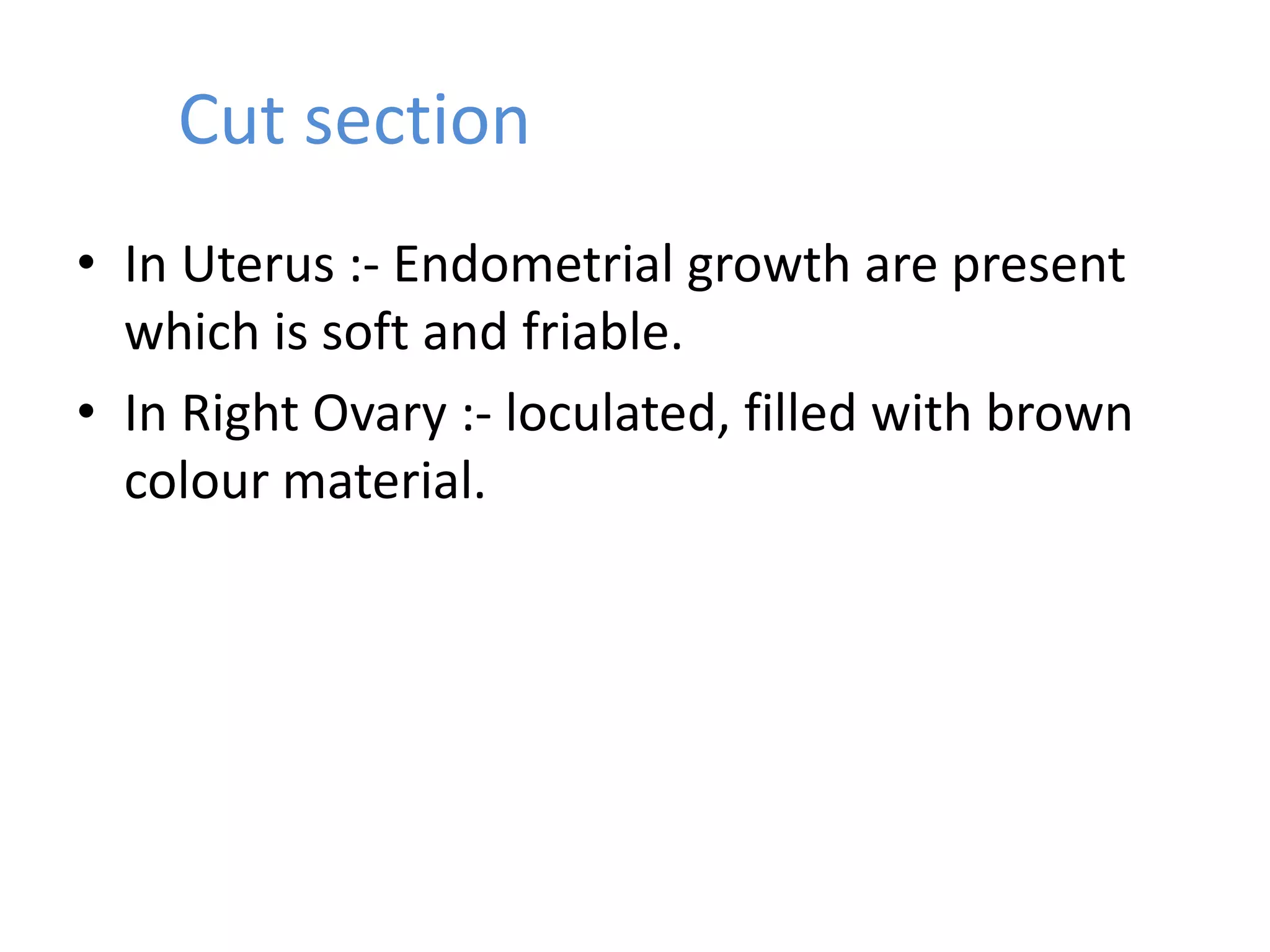 endometria ca.pptx