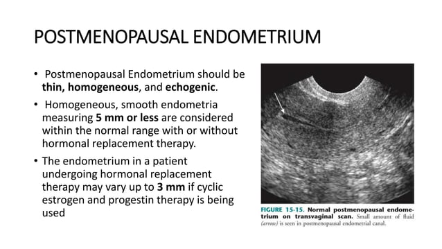 Endometrial abnormalities | PPTX
