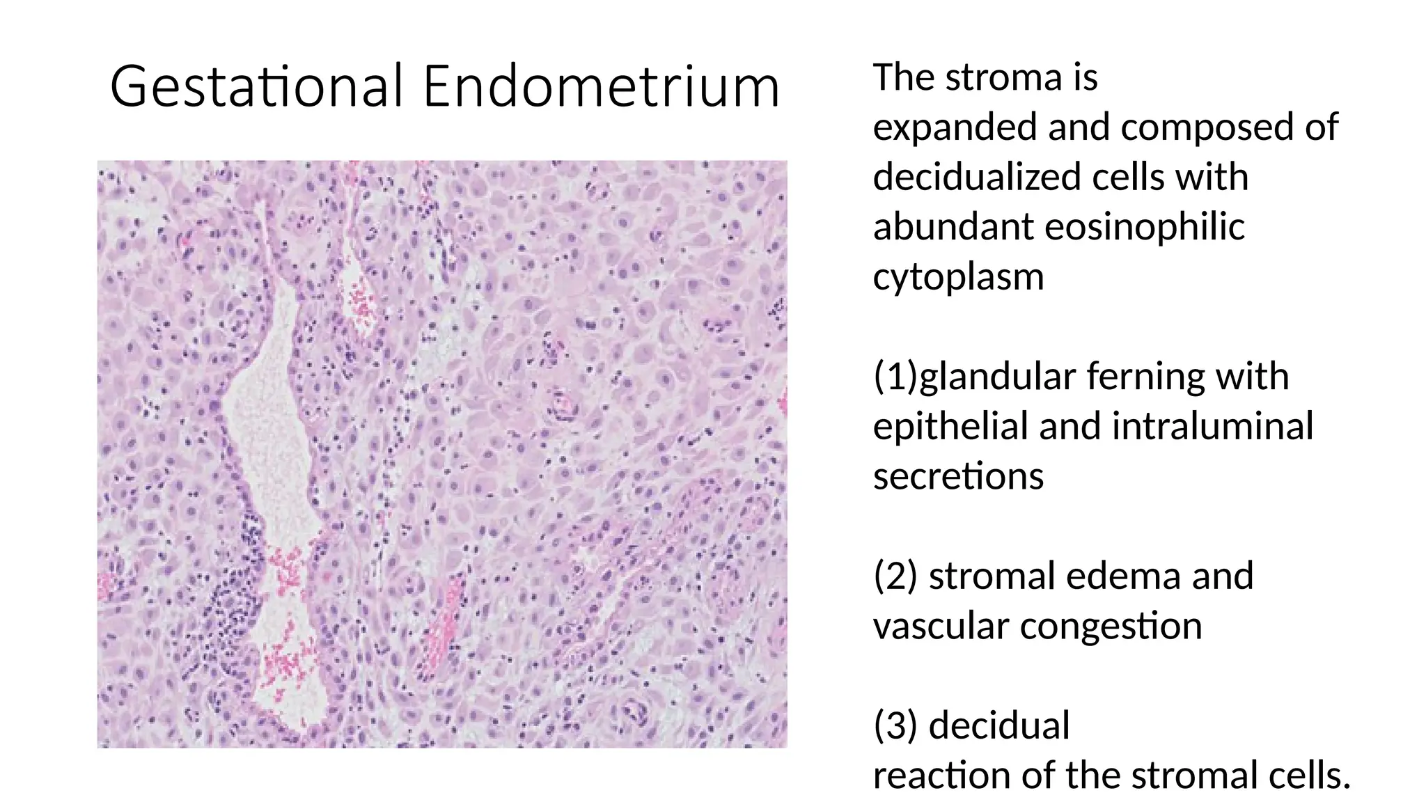 Endometrial biopsy - interpretation.pptx