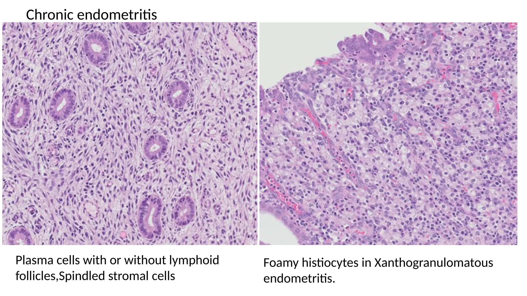 Endometrial biopsy - interpretation.pptx