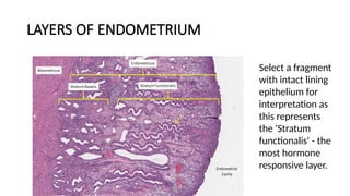 Endometrial biopsy - interpretation.pptx