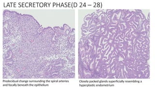 Endometrial biopsy - interpretation.pptx