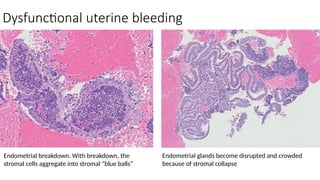 Endometrial biopsy - interpretation.pptx