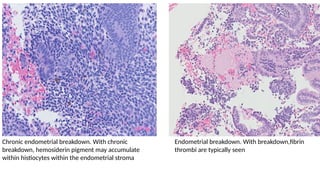 Endometrial biopsy - interpretation.pptx