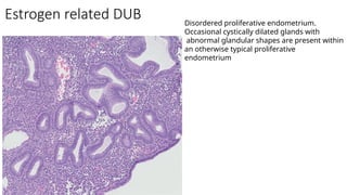 Endometrial biopsy - interpretation.pptx