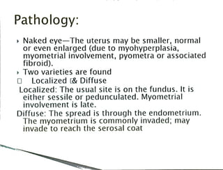 Endometrial Carcinoma - Gynaecology MBBS | PDF