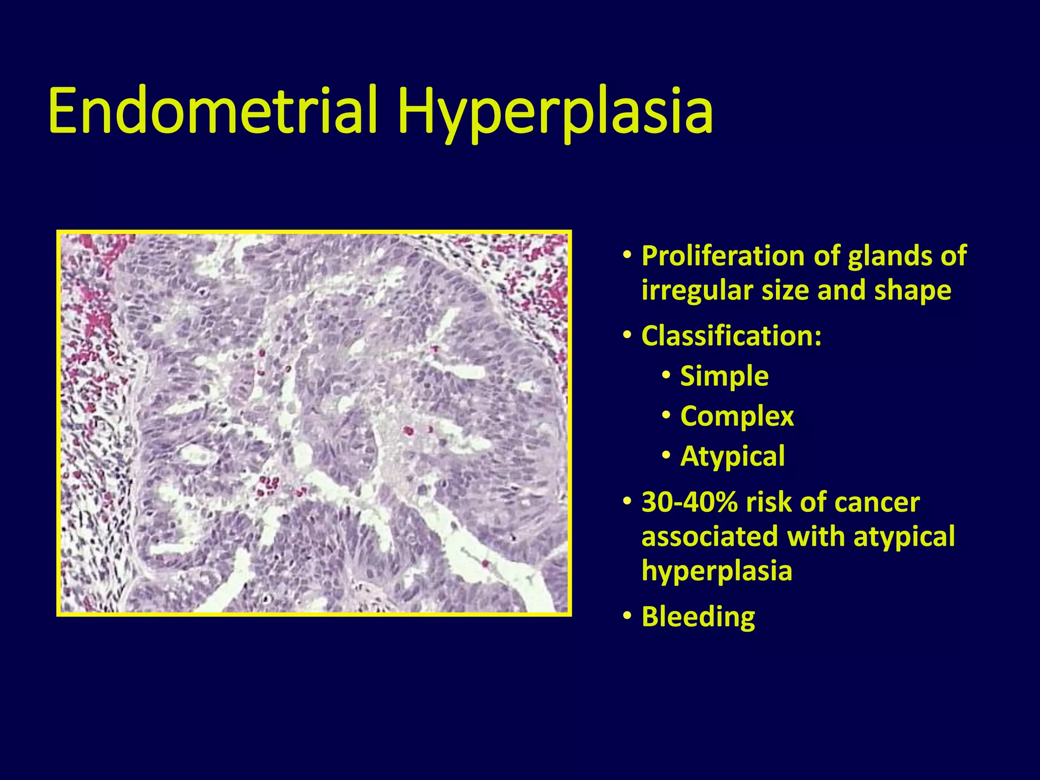 Uterine and Endometrial Cancer 101 | PPT