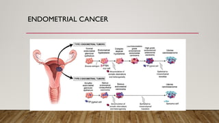 Endometrial cancer JOURNAL mri and ct.pptx