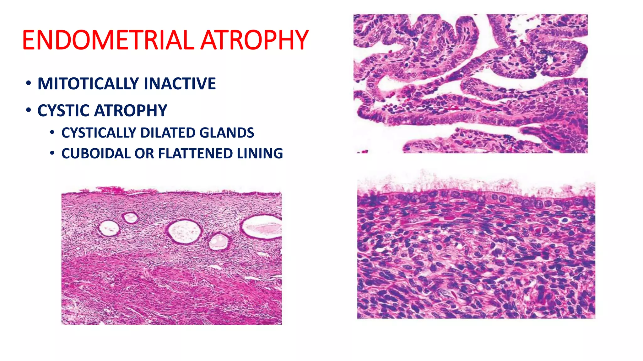 ENDOMETRIAL DATING.pptx