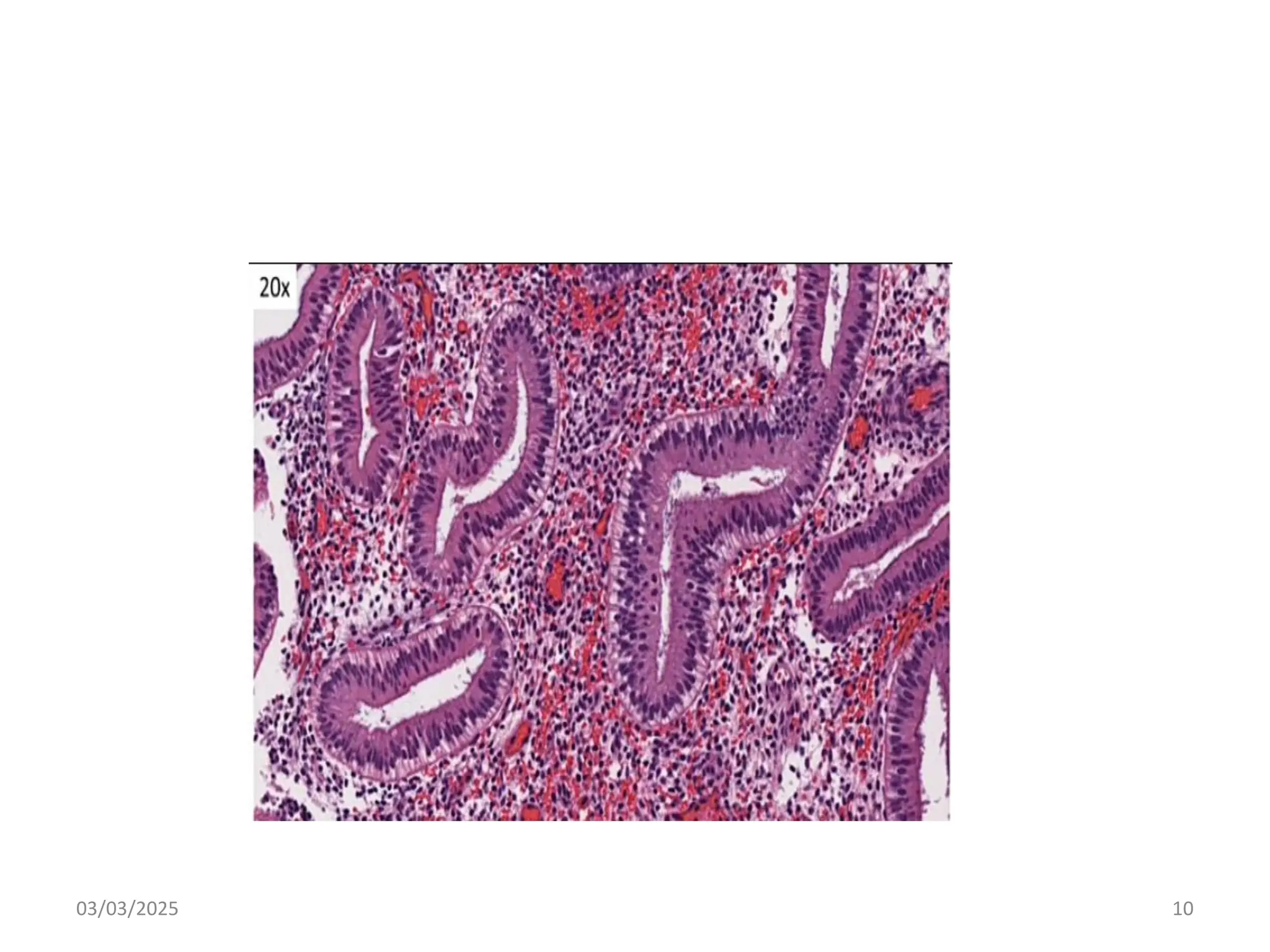 Endometrial Histology: Normal findings, artefacts and metaplasia | PDF