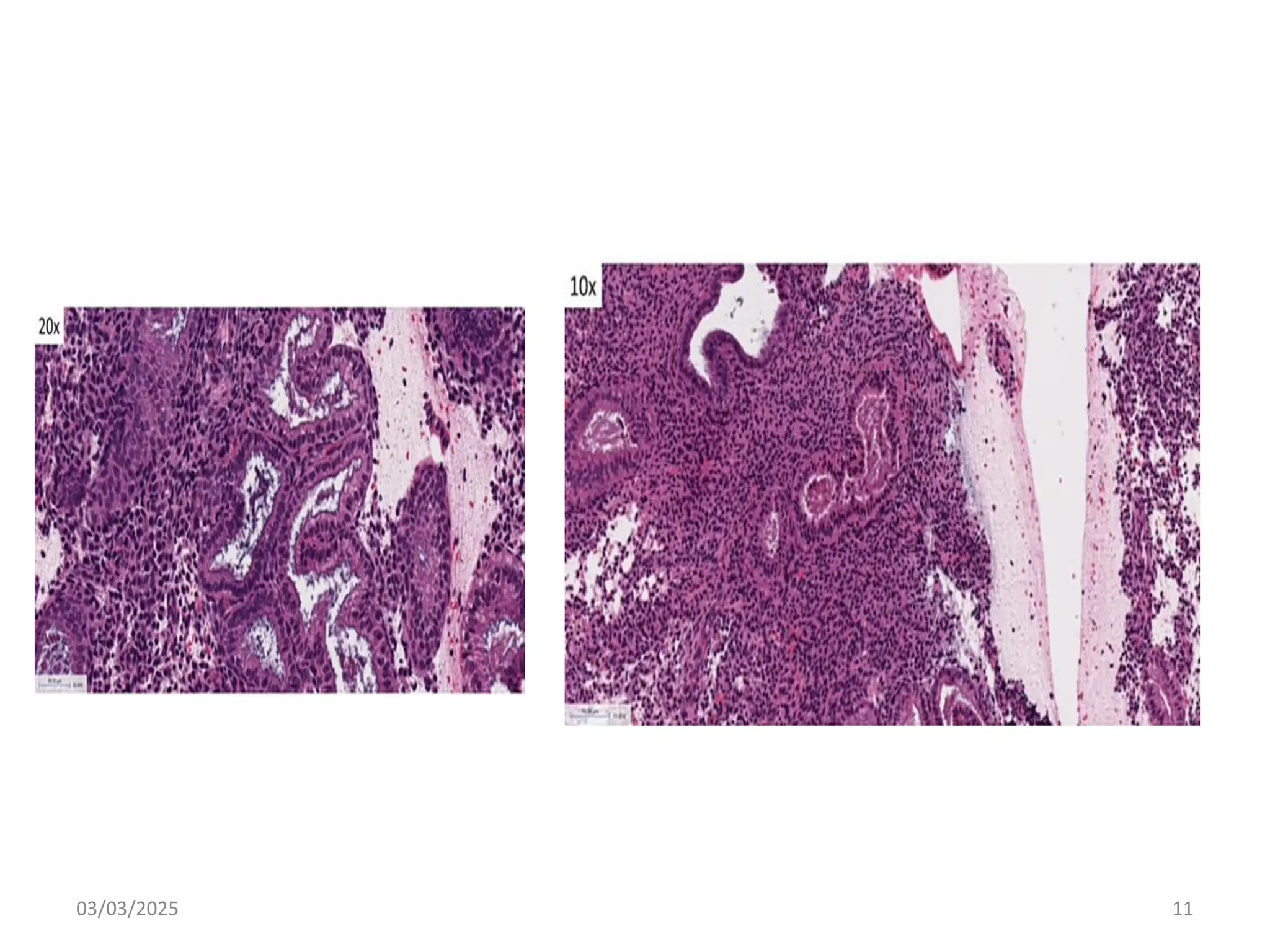 Endometrial Histology: Normal findings, artefacts and metaplasia | PDF