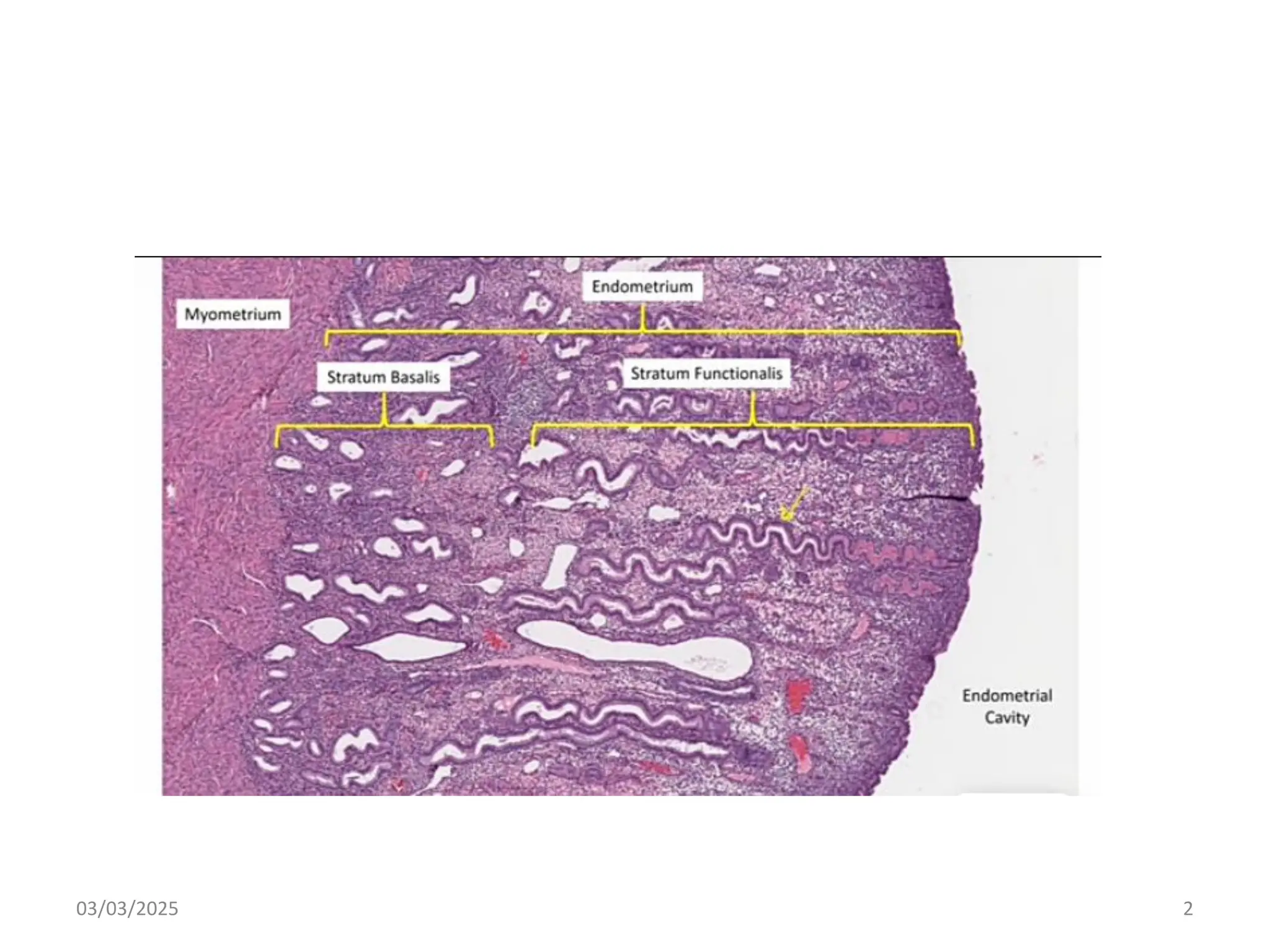 Endometrial Histology: Normal findings, artefacts and metaplasia | PDF