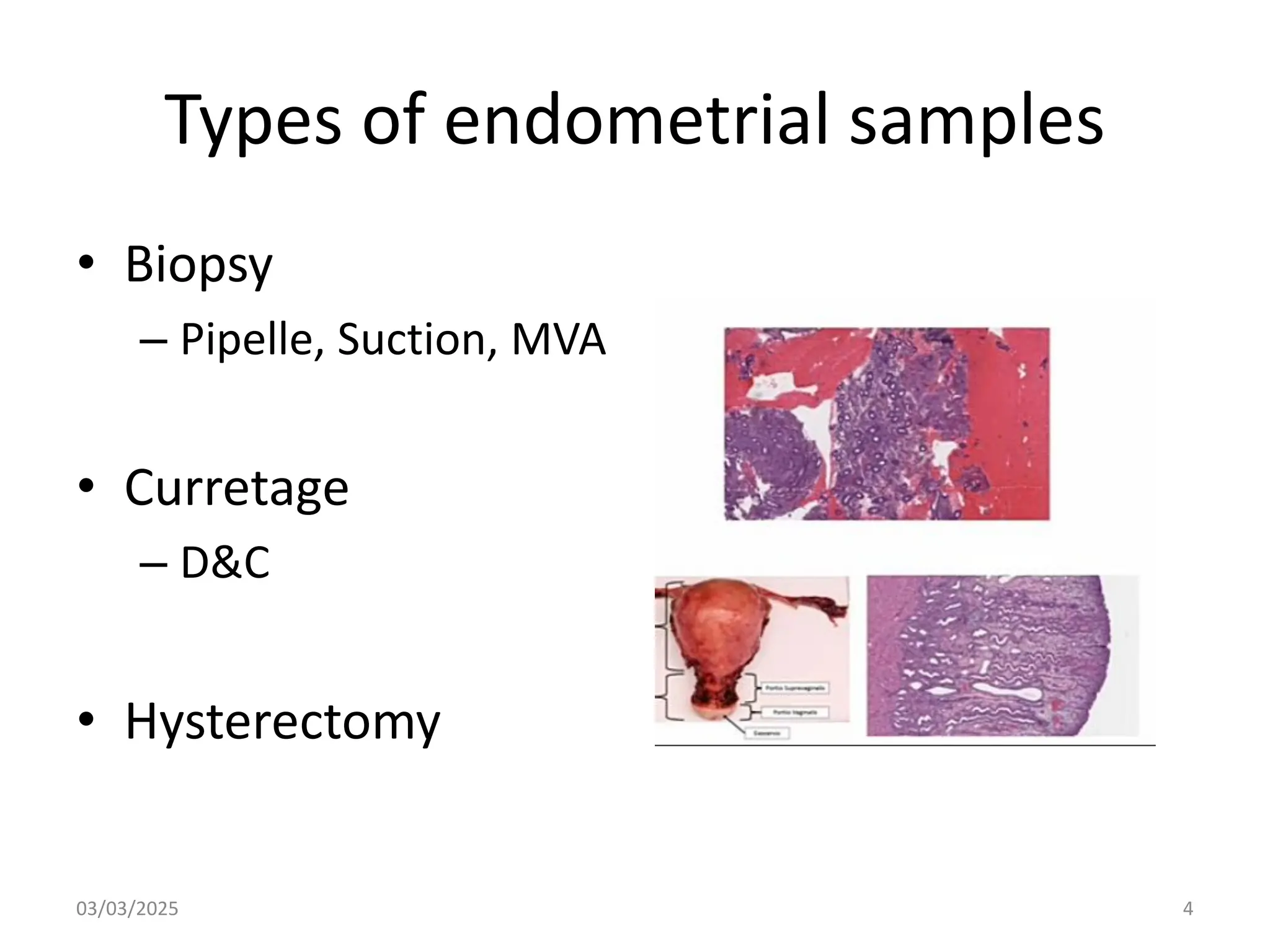 Endometrial Histology: Normal findings, artefacts and metaplasia | PDF