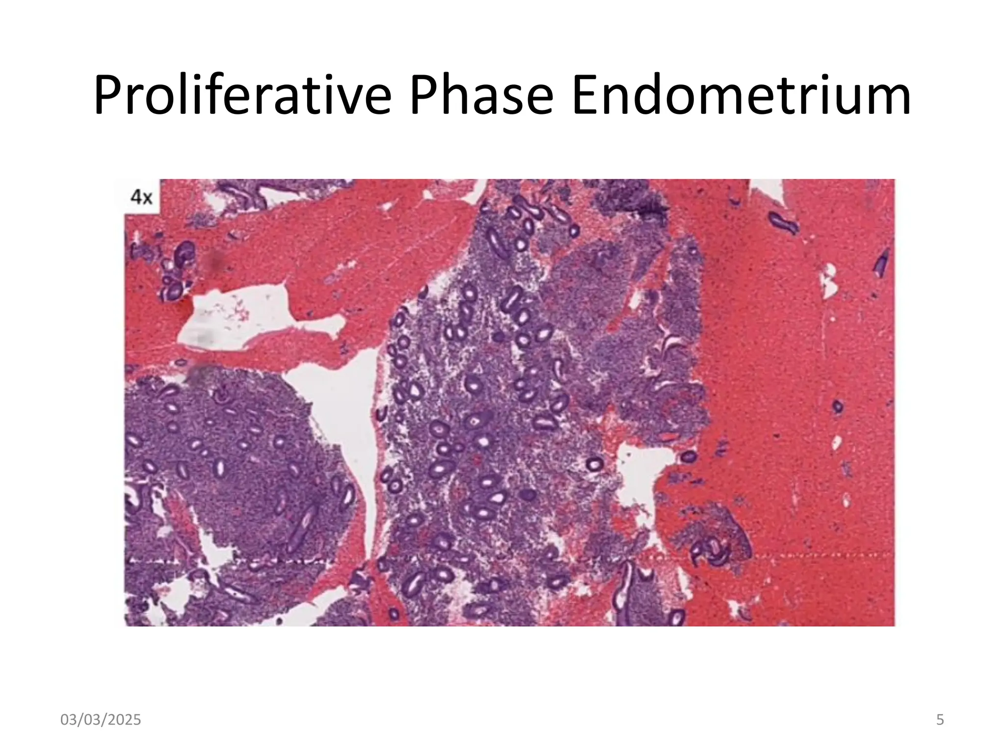 Endometrial Histology: Normal findings, artefacts and metaplasia | PDF