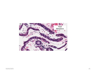 Endometrial Histology: Normal findings, artefacts and metaplasia | PDF