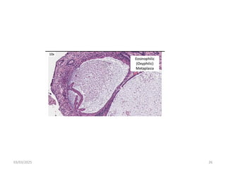 Endometrial Histology: Normal findings, artefacts and metaplasia | PDF