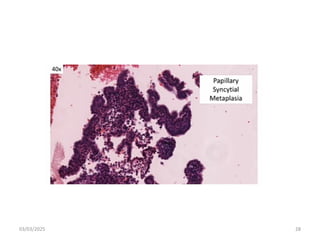 Endometrial Histology: Normal findings, artefacts and metaplasia | PDF