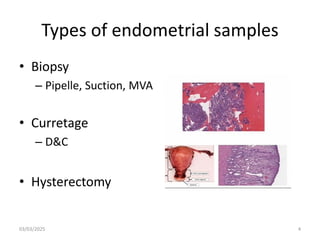 Endometrial Histology: Normal findings, artefacts and metaplasia | PDF