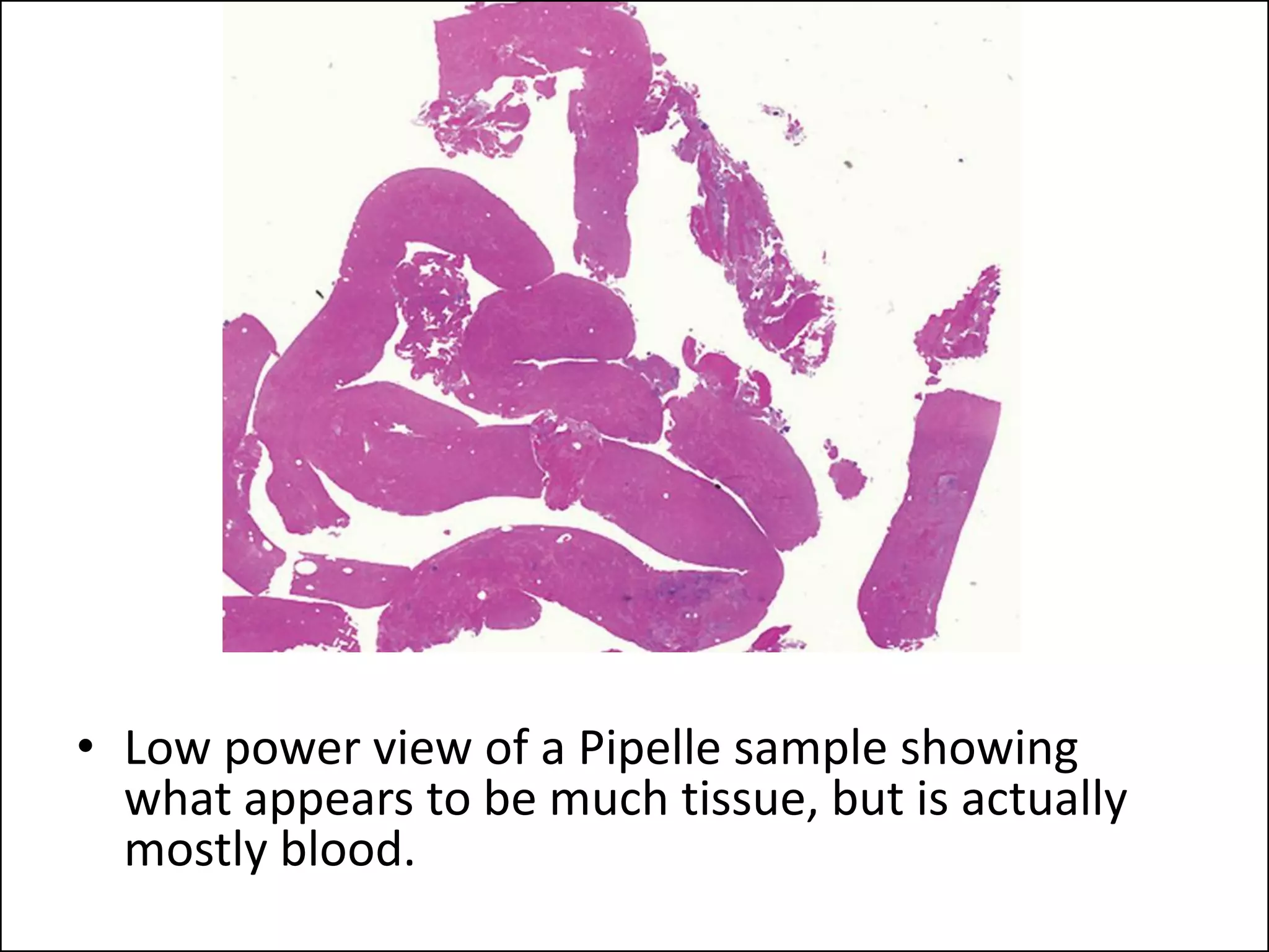 Endometrial histopathology-Basics | PDF