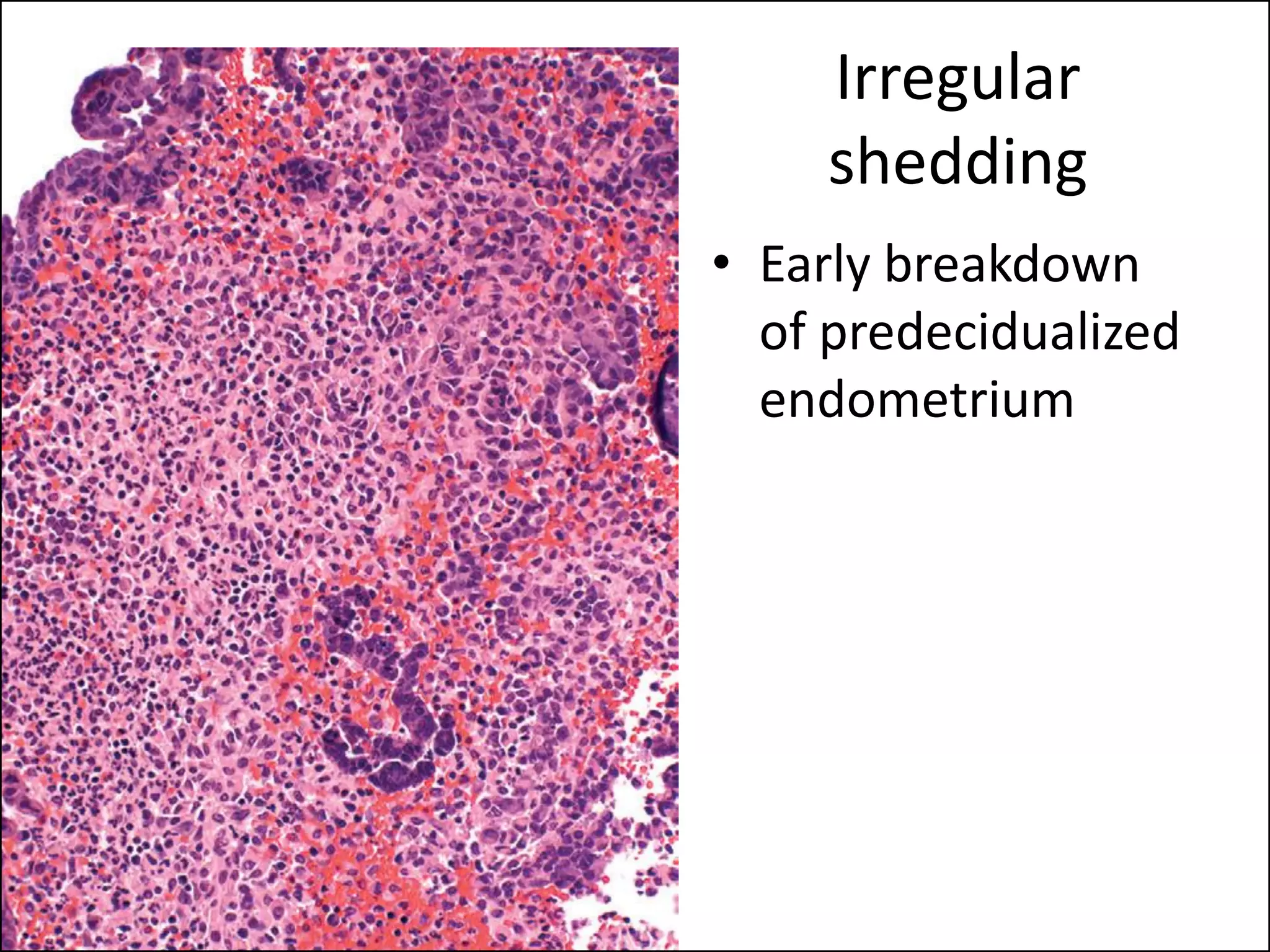 Endometrial histopathology-Basics | PDF