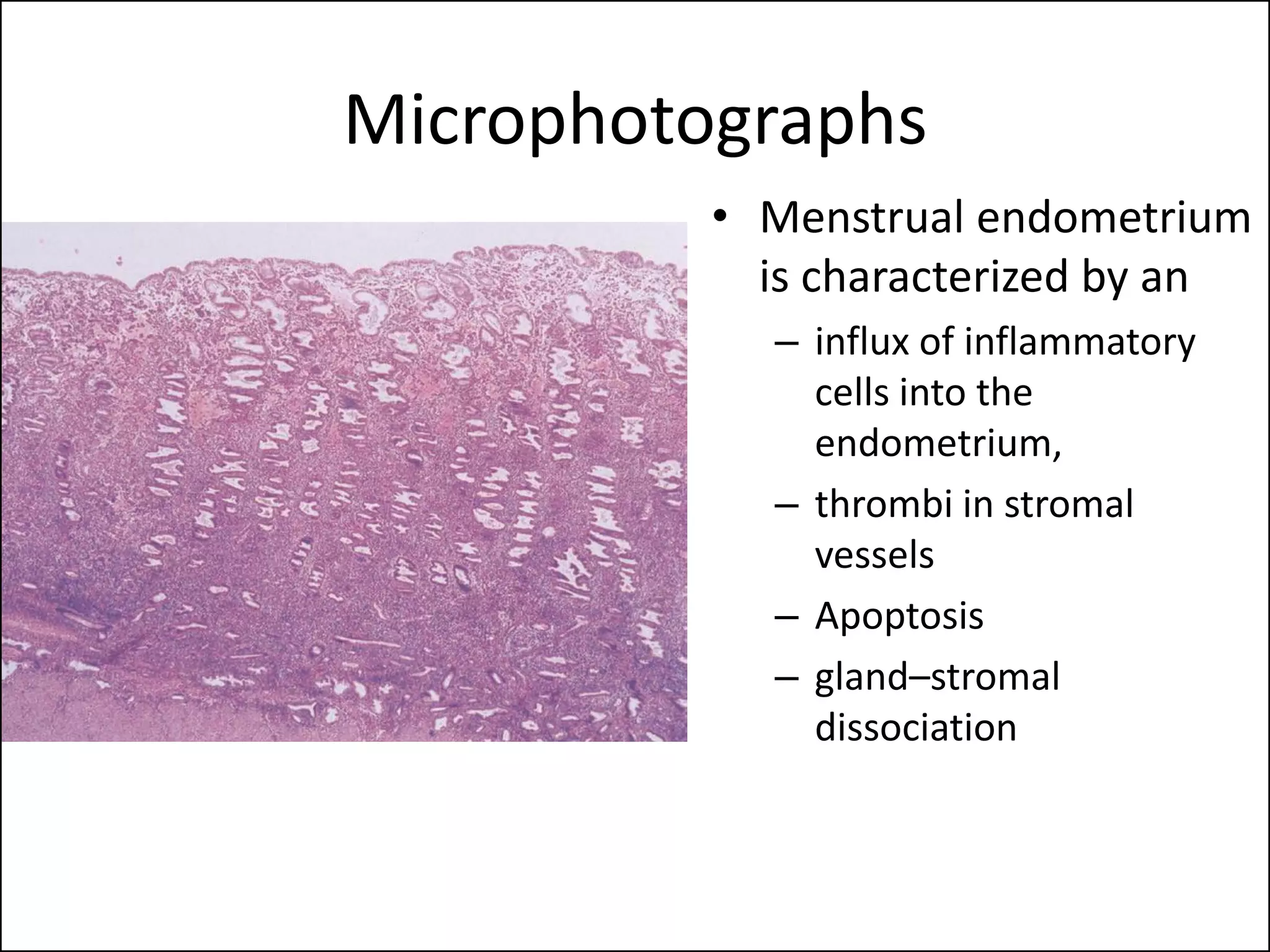 Endometrial histopathology-Basics | PDF