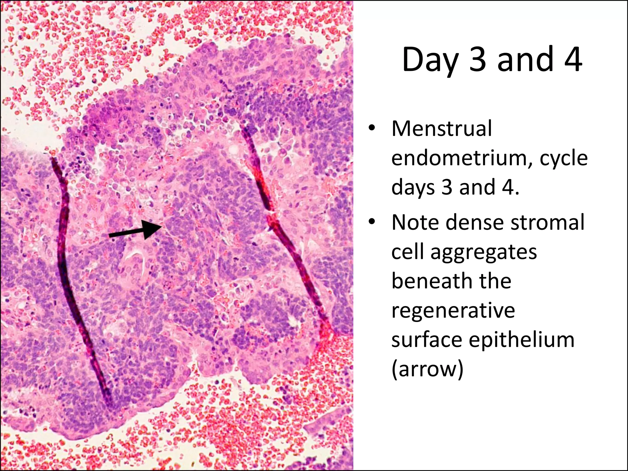 Endometrial histopathology-Basics | PDF